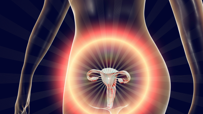 Intramural uterine fibroids